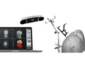 NeuroNavegador Quirurgico - Coditech